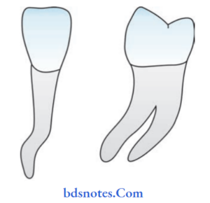 Dilaceration: When Teeth Take a Turn - BDS Notes