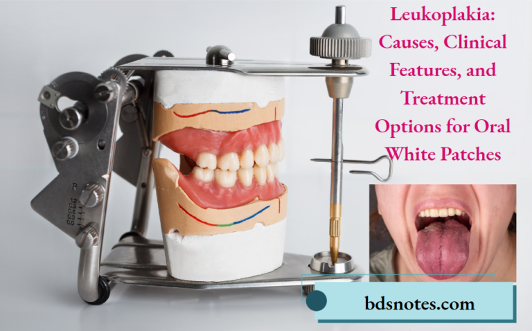 Leukoplakia: Causes, Clinical Features, and Treatment Options for Oral ...