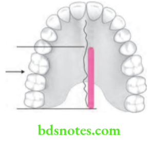 Paralleling Technique In Dental Radiography - BDS Notes