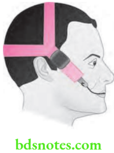 Headgear - BDS Notes