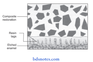 Acid Etching - BDS Notes