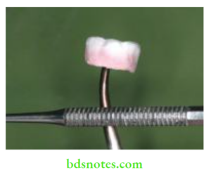 Ceramic Systems Classification and Types Of Metal-Ceramic Systems Notes ...