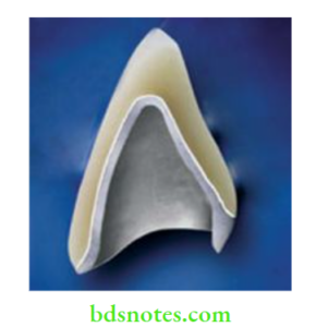 Ceramic Systems Classification and Types Of Metal-Ceramic Systems Notes ...