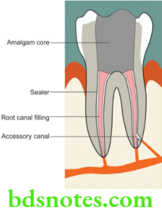 Endodontic Sealers And Obturating Materials Notes - BDS Notes