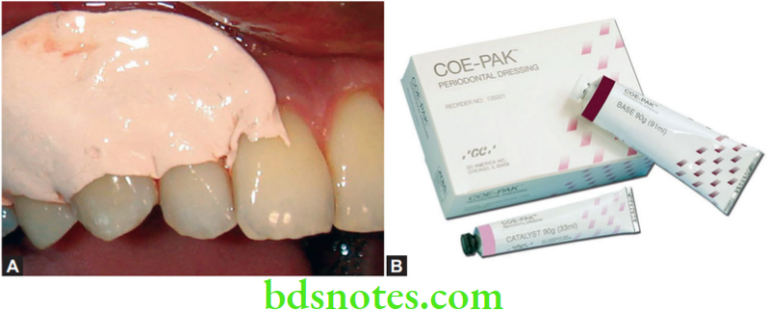 Rigid Impression Materials Dental Material Notes - BDS Notes