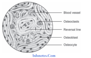 Diseases Of Bone And Joints Question And Answers - BDS Notes