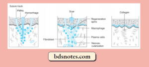 Wound Healing by Primary Intention: Stages, Mechanism, and Modifying ...