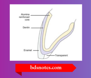 Ceramic Systems Classification and Types Of Metal-Ceramic Systems Notes ...