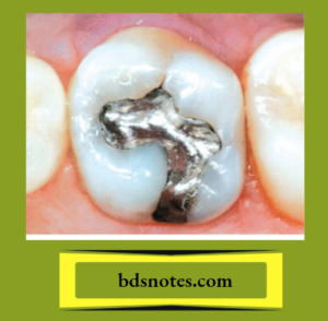 Dental Amalgam Alloys: Low Copper vs. High Copper Explained - BDS Notes