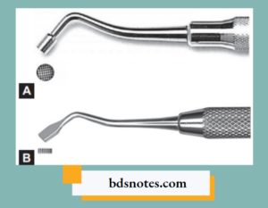 Dental Amalgam Alloys: Low Copper vs. High Copper Explained - BDS Notes