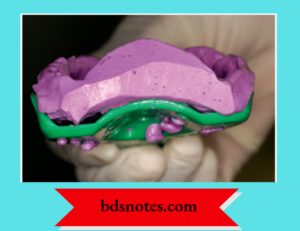 Elastic Impression Materials in Dentistry - BDS Notes