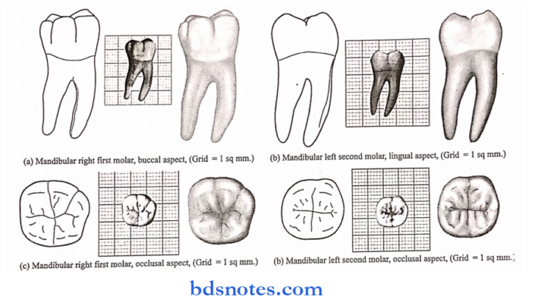 Permanent Mandibular Molars Question And Answers - BDS Notes