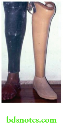 Ulcer Classification and Venous Leg Ulcer Treatment Notes - BDS Notes