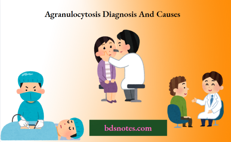 Agranulocytosis Diagnosis and Causes - BDS Notes