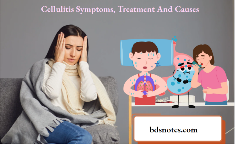 Cellulitis Symptoms, Treatment And Causes - BDS Notes