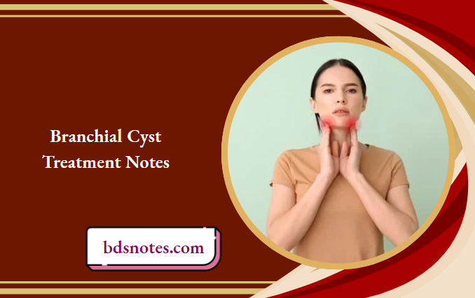 Branchial Cyst Treatment Notes - BDS Notes