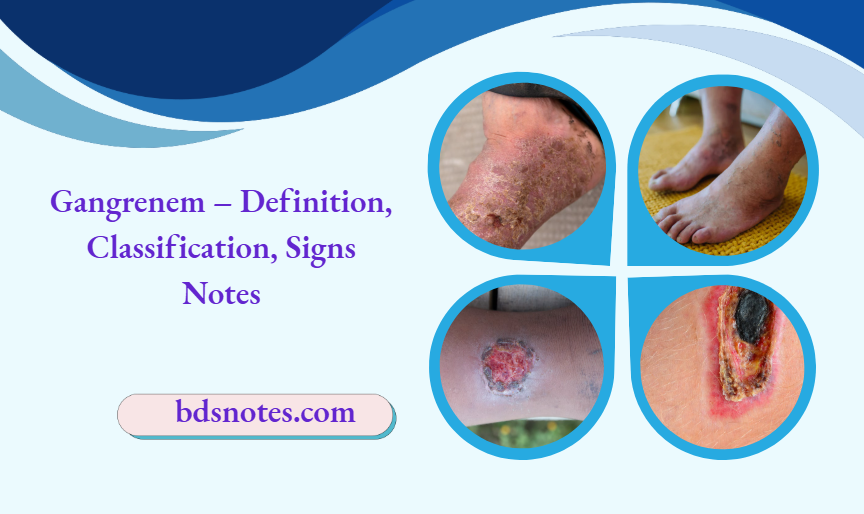 Gangrenem - Definition, Classification, Signs Notes - BDS Notes