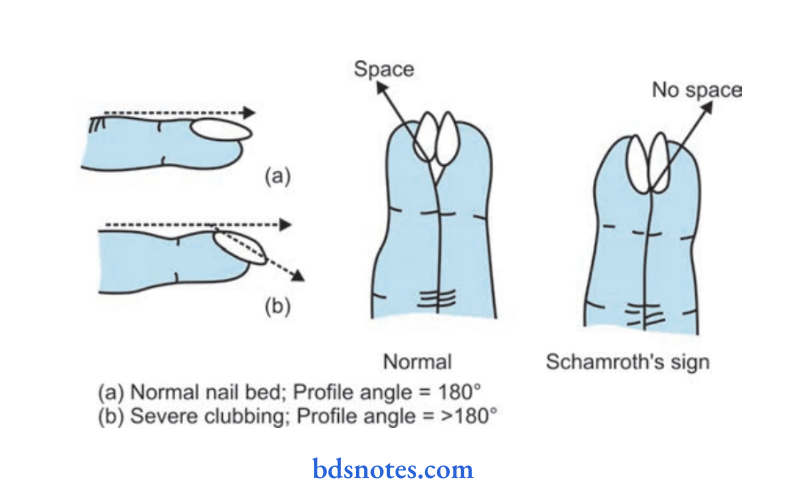 Dysphagia Hematuria General Medicine - BDS Notes