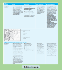 Coagulative Necrosis in Infarcts – What You Need to Know - BDS Notes