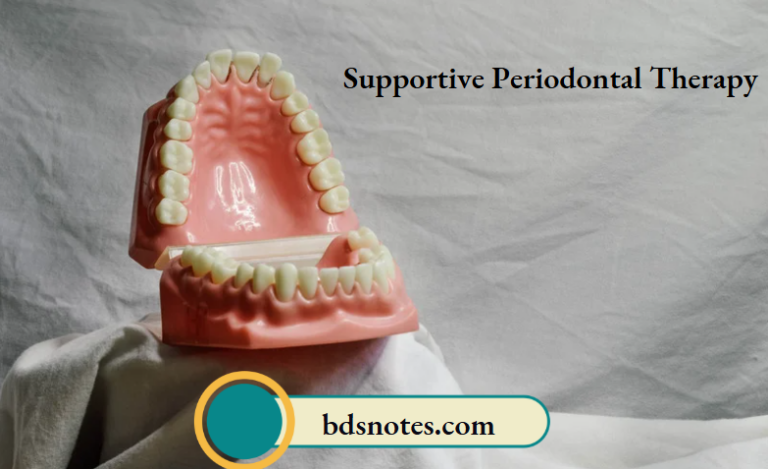 Supportive Periodontal Therapy - BDS Notes