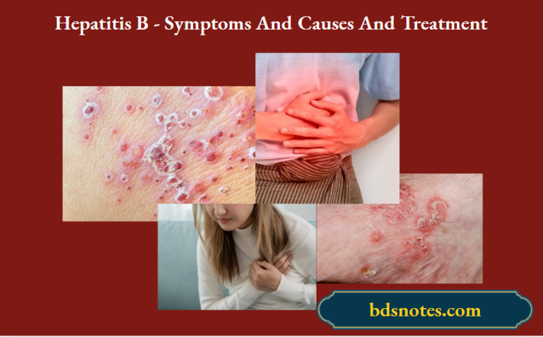 Hepatitis B - Symptoms And Causes and Treatment - BDS Notes