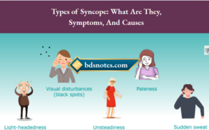 Types of Syncope: What Are They, Symptoms, and Causes - BDS Notes