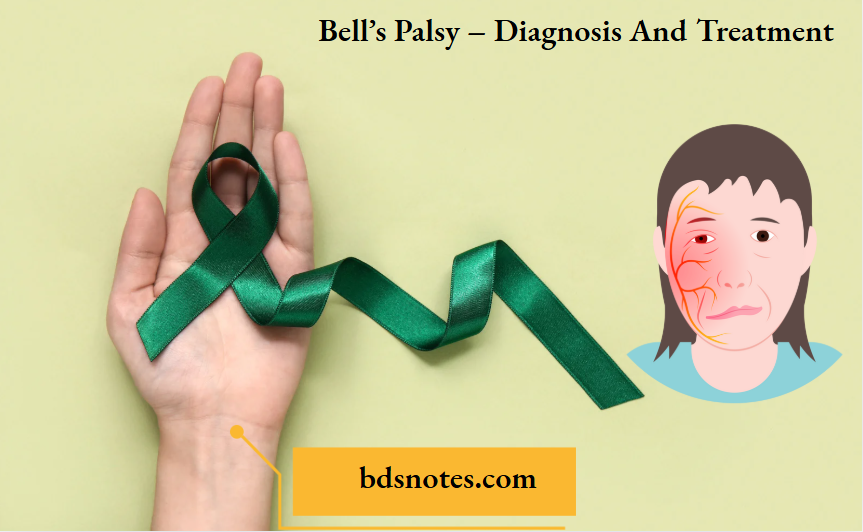 Bell's Palsy - Diagnosis And Treatment - BDS Notes