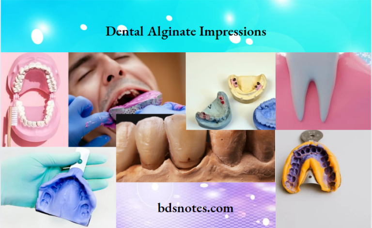Dental Alginate Impressions - BDS Notes