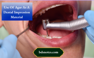 Use Of Agar As A Dental Impression Material - BDS Notes