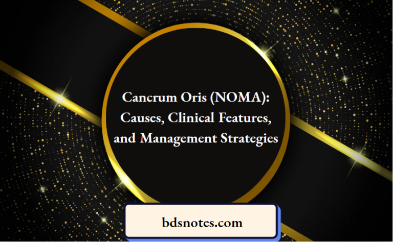 Cancrum Oris (NOMA): Causes, Clinical Features, and Management ...