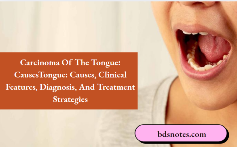 Carcinoma of the Tongue: Causes, Clinical Features, Diagnosis, and ...