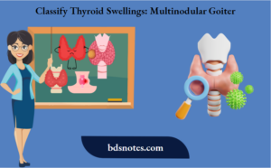 Classify Thyroid Swellings: Multinodular Goiter - BDS Notes