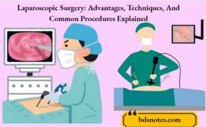 Laparoscopic Surgery: Advantages, Techniques, and Common Procedures ...
