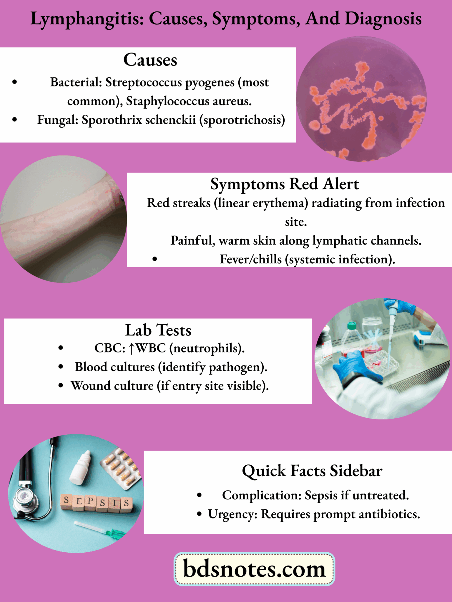 Lymphangitis: Causes, Symptoms, And Diagnosis - BDS Notes