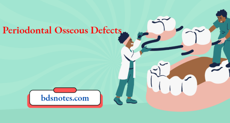 Periodontal Osseous Defects - BDS Notes