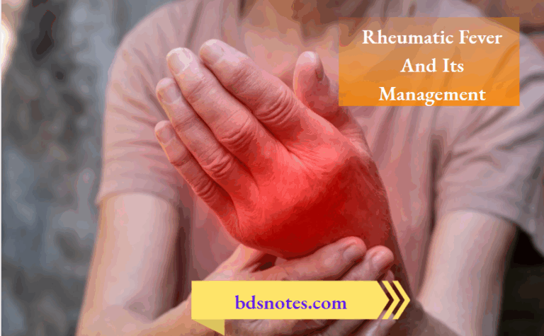 Rheumatic Fever And Its Management - BDS Notes